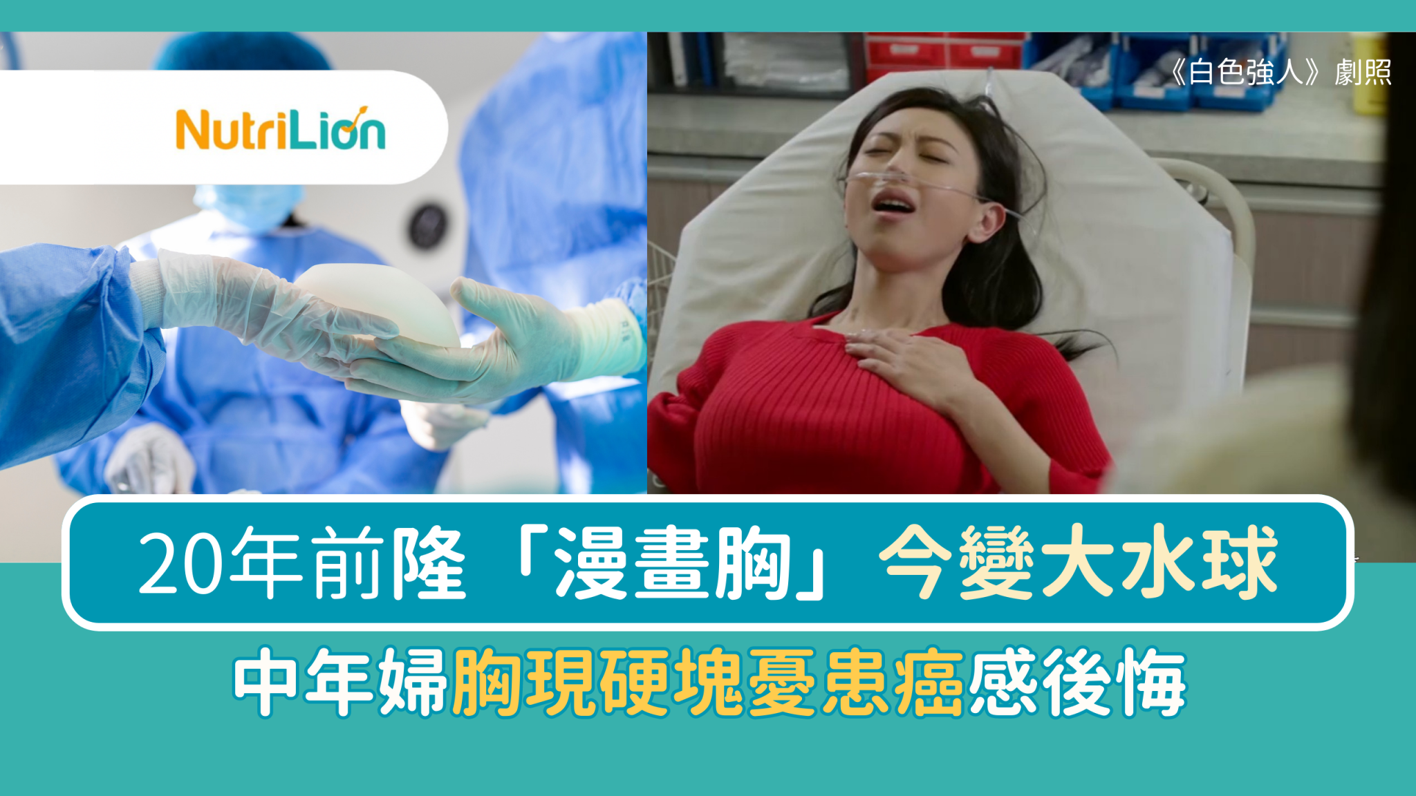 【隆胸危機】20年前隆「漫畫胸」今變大水球 中年婦胸現硬塊憂患癌感後悔 - NutriLion 營養獅
